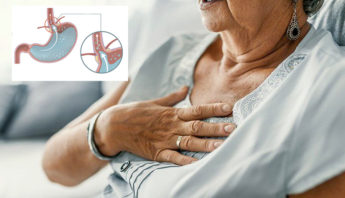 aLittleBitOfAll | Heartburn and Gastroesophageal Reflux Disease ...